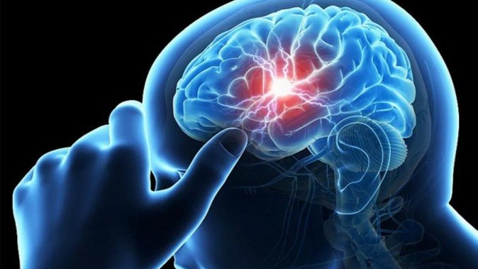Stress Paralysis: Signs, Risk Factors, Treatment Options